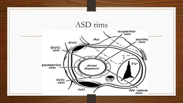 Asd device closure | PPTX