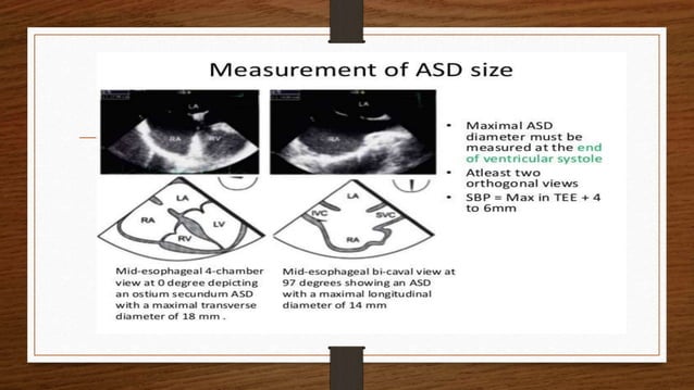 Asd device closure | PPTX