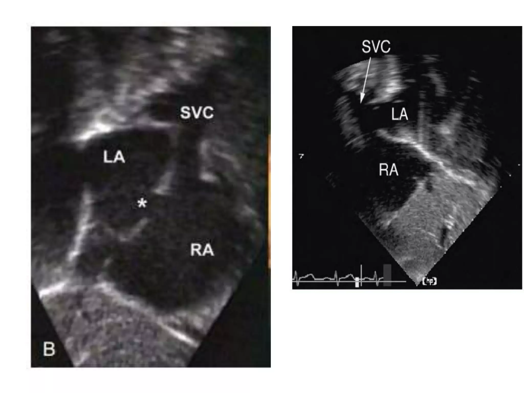Asd echo assessment | PPTX