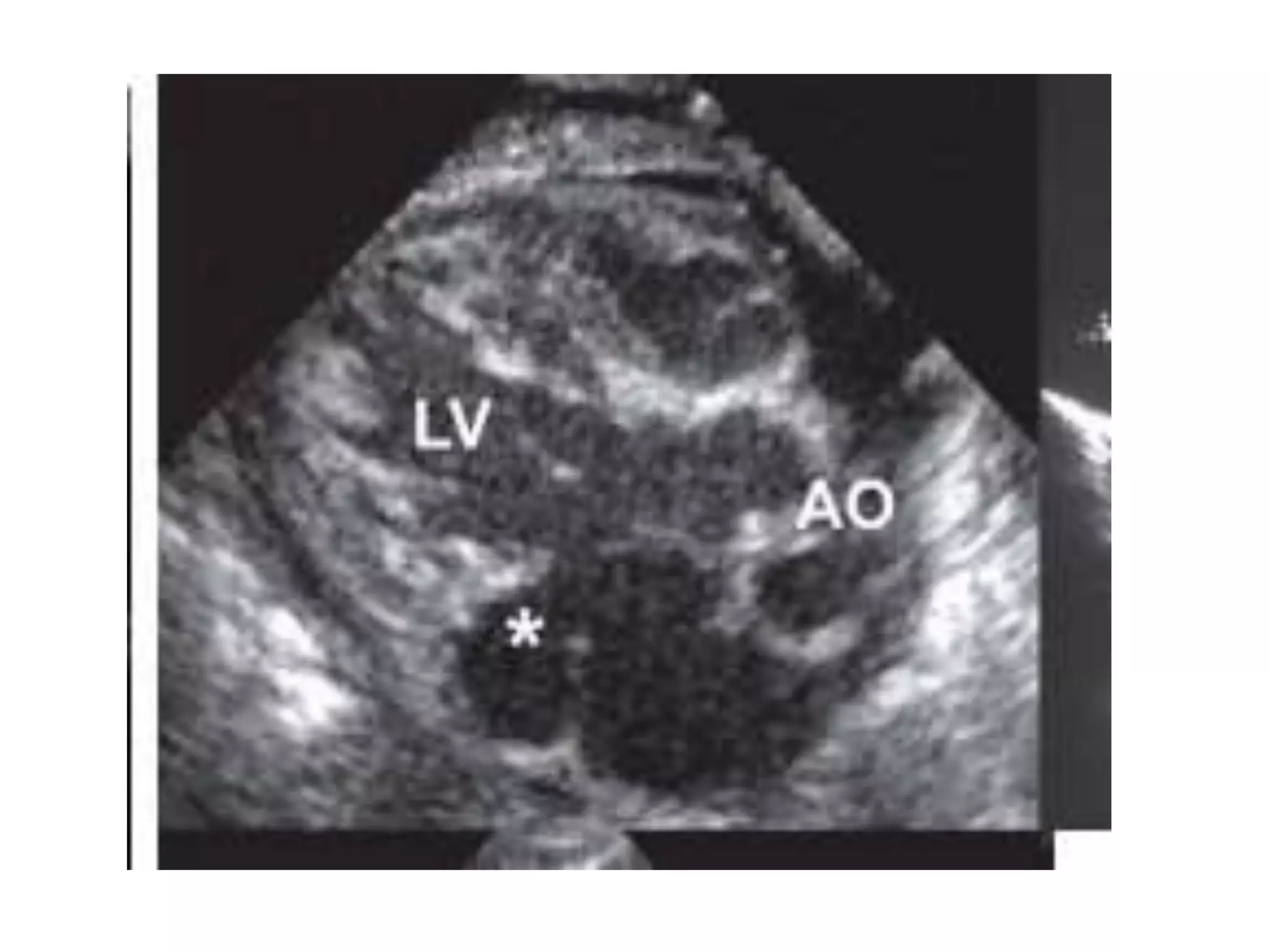 Asd echo assessment | PPTX