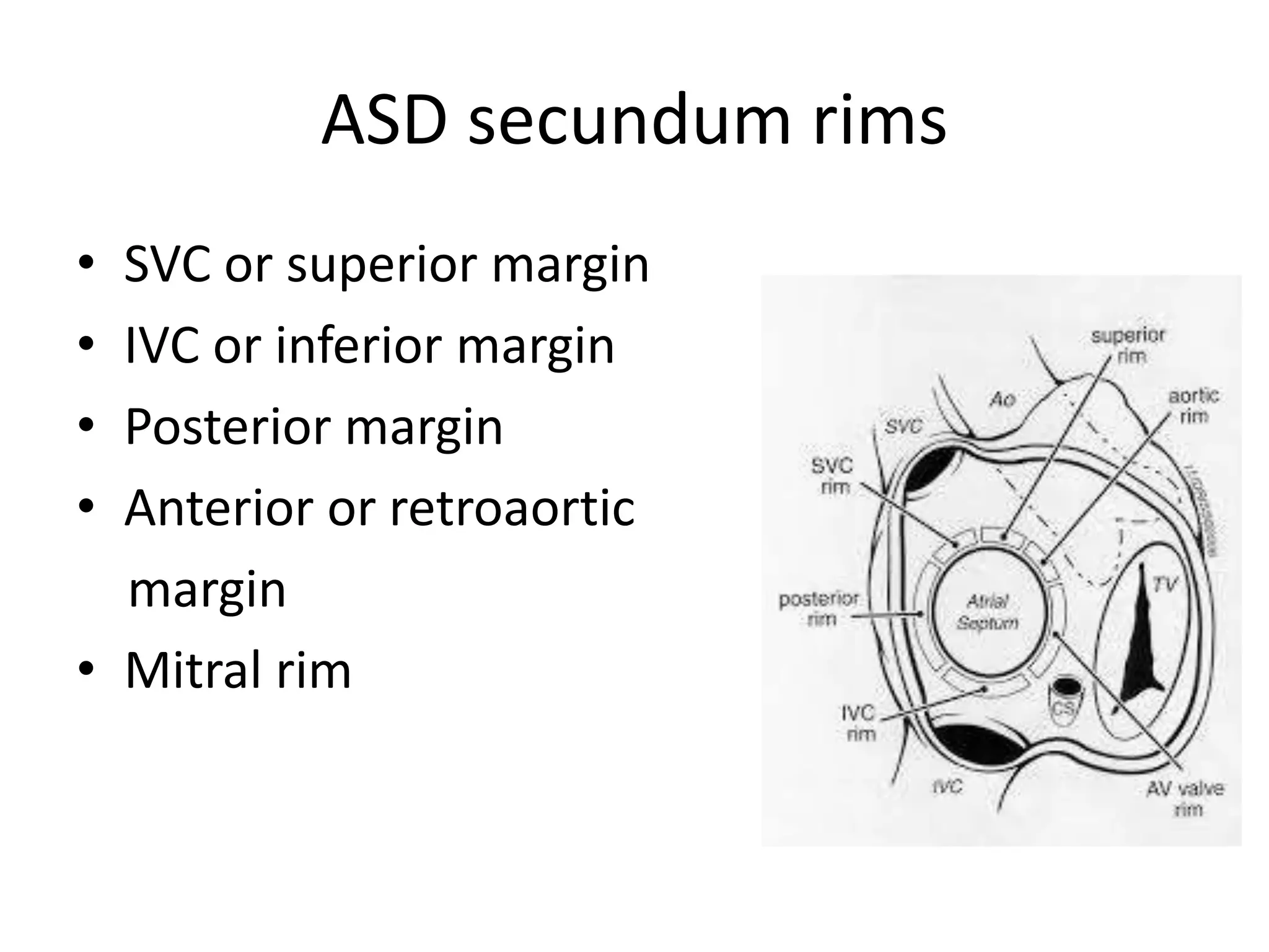 Asd echo assessment | PPTX