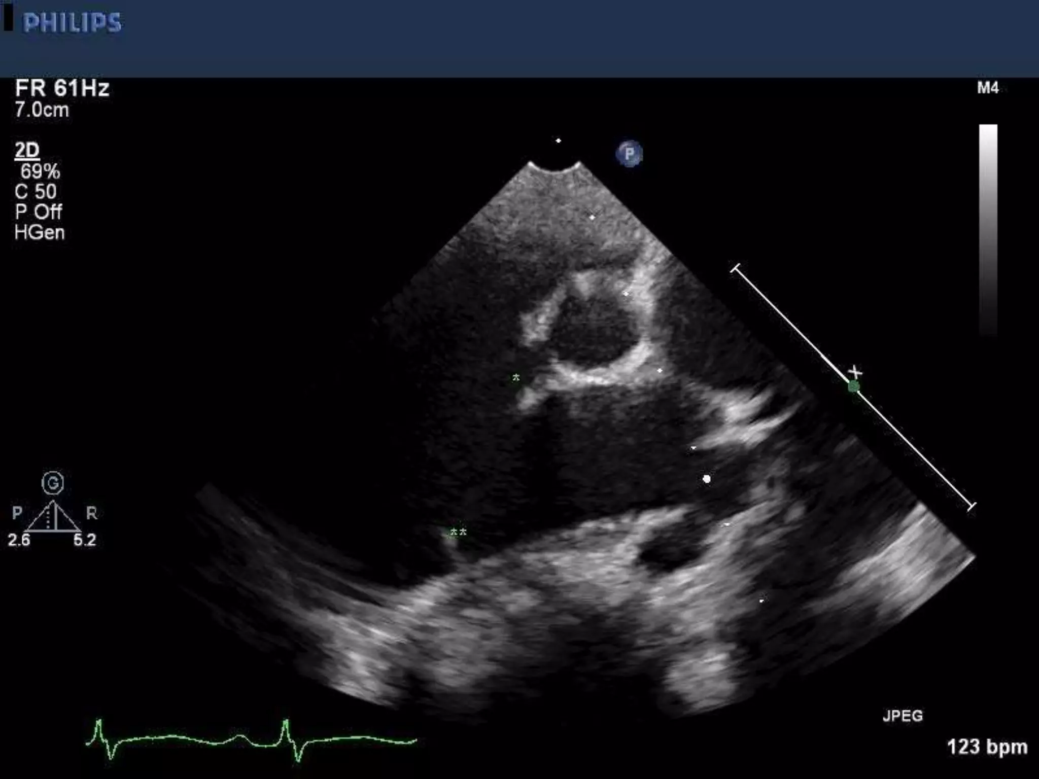 Asd echo assessment | PPTX