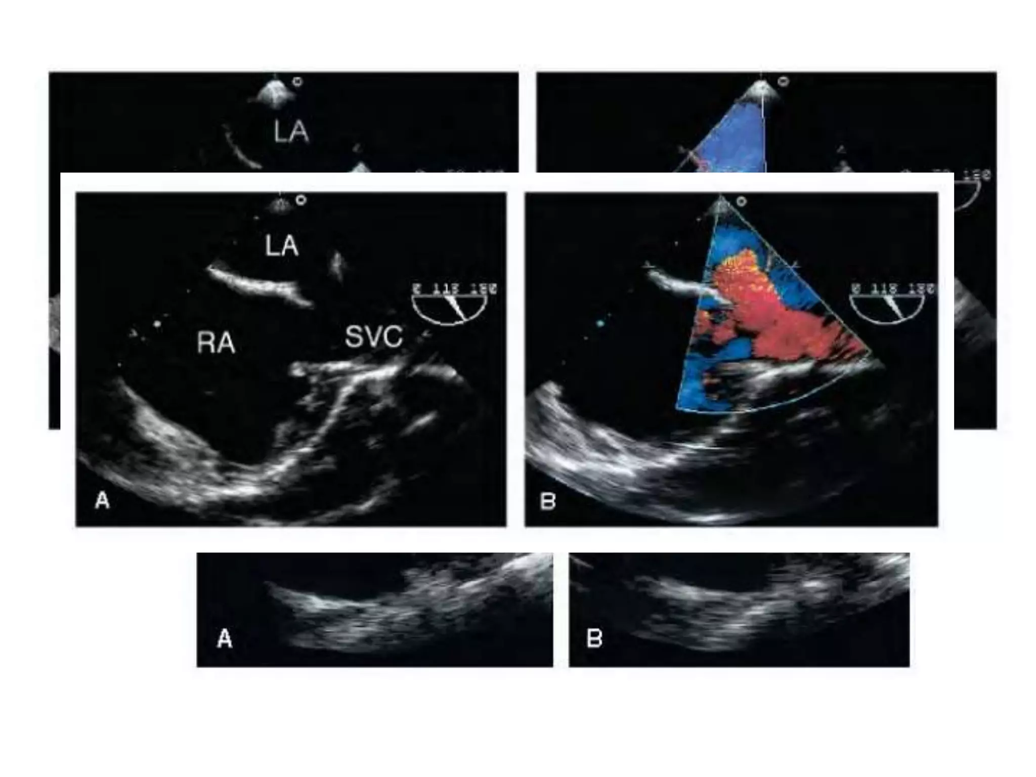 Asd echo assessment | PPTX