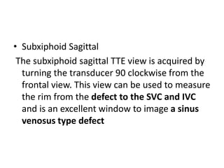 Asd echo assessment | PPTX