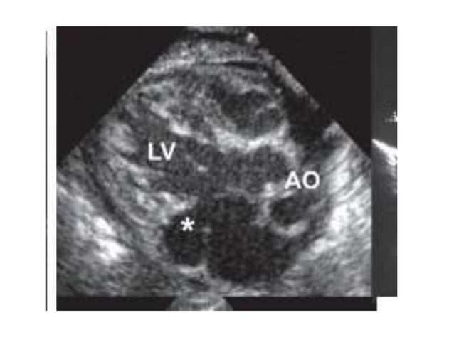 Asd echo assessment | PPTX