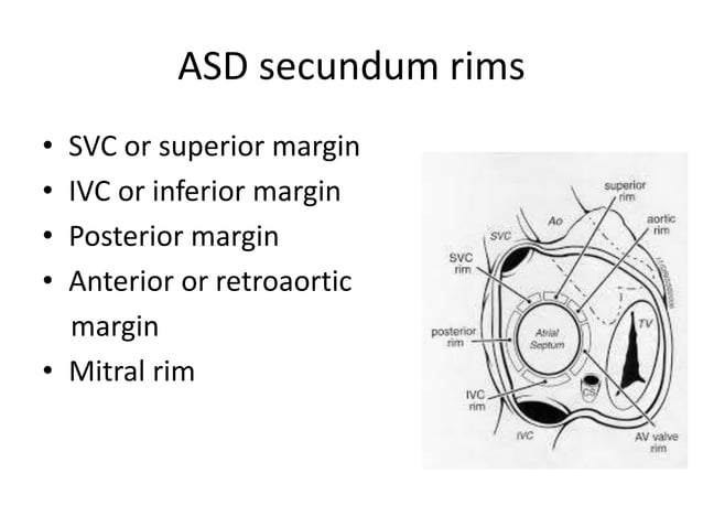 Asd echo assessment | PPTX