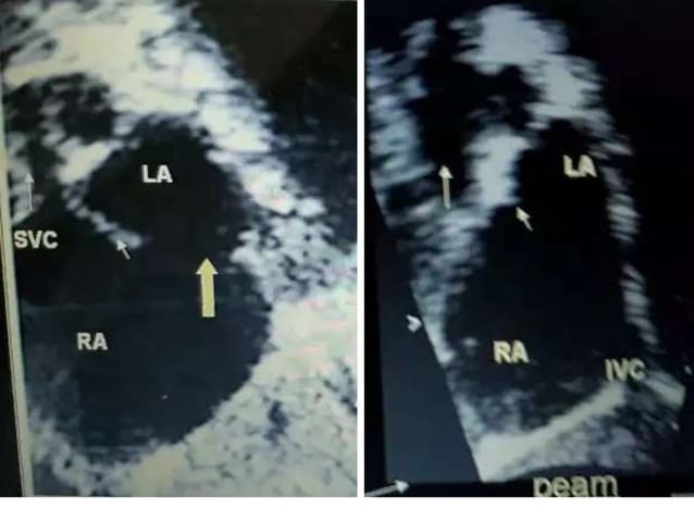 Asd echo assessment | PPTX