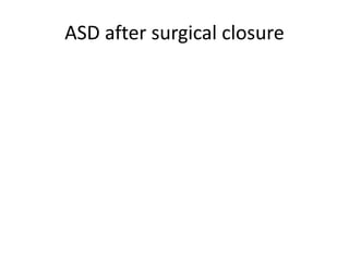 Asd echo assessment | PPTX