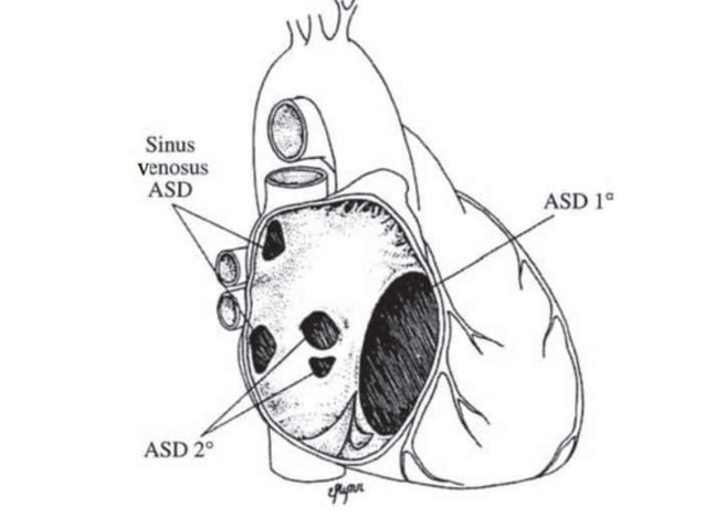 Asd echo assessment | PPTX