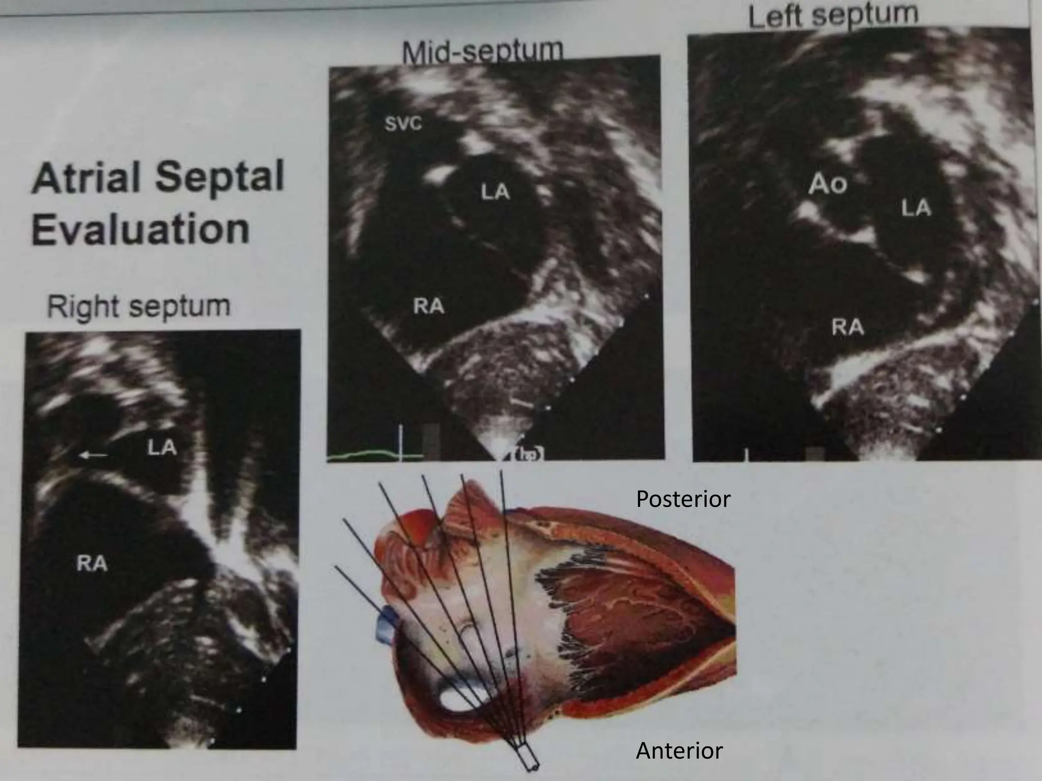 ASD ECHO ASSESSMENT renewed slideshow.pptx