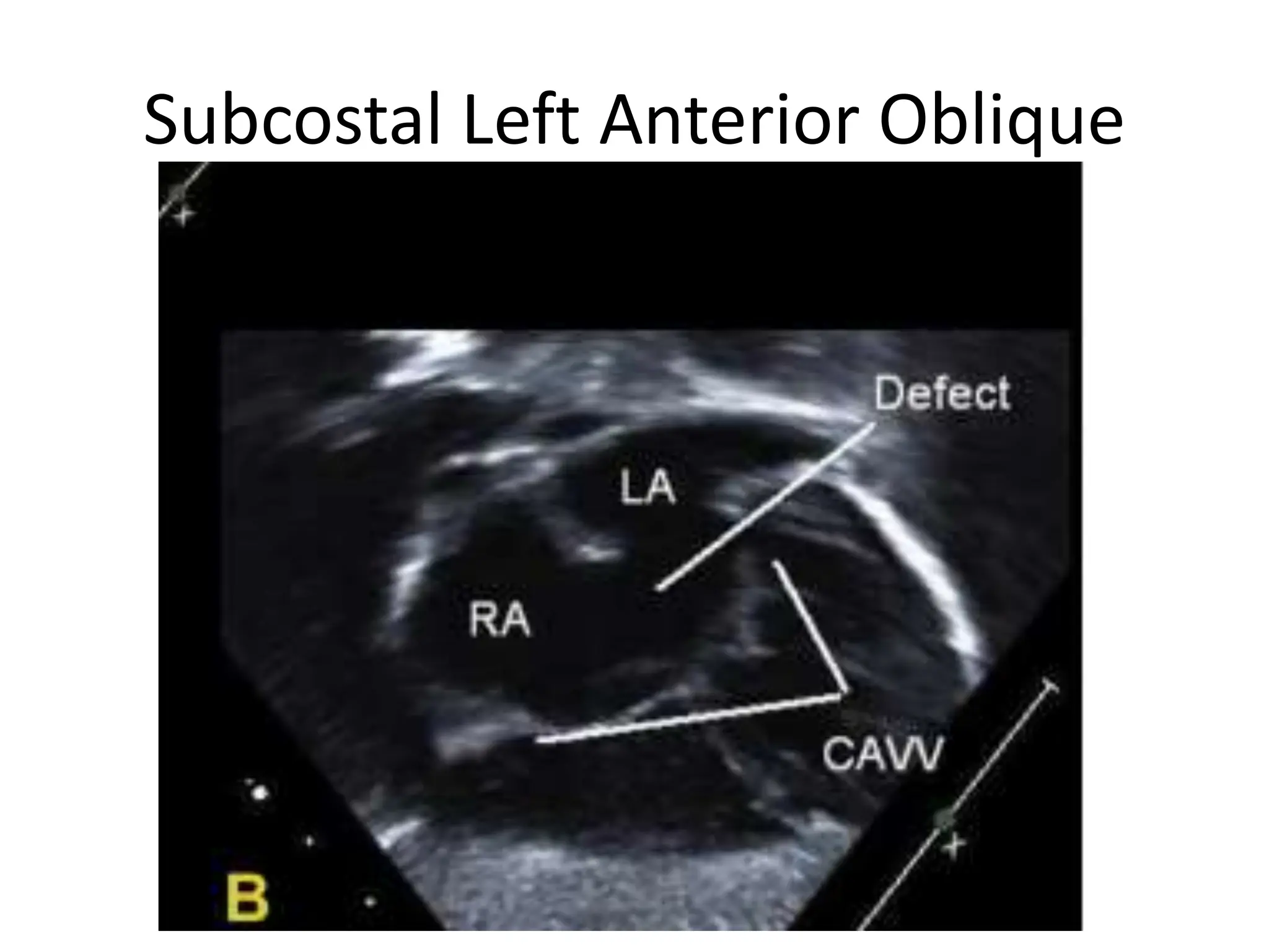 ASD ECHO ASSESSMENT renewed slideshow.pptx