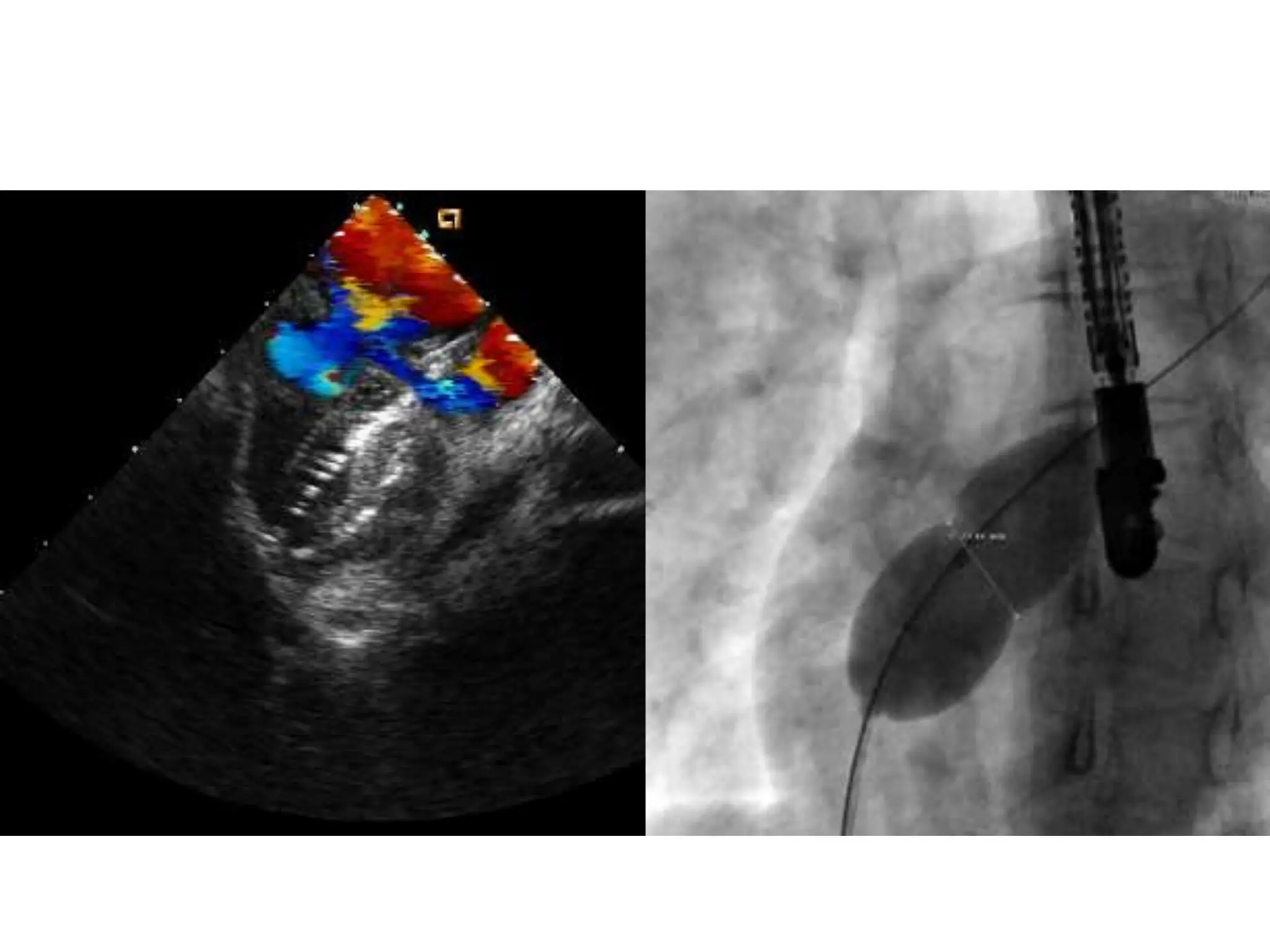 ASD ECHO ASSESSMENT renewed slideshow.pptx