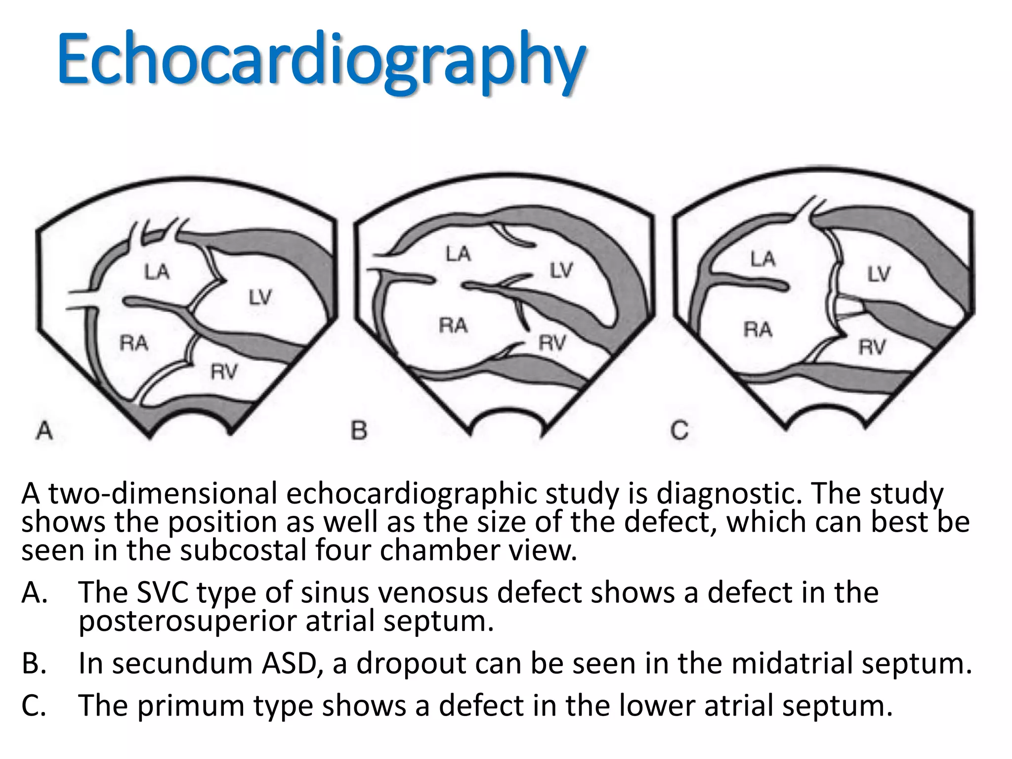 Atrial Septal Defect | PPTX