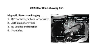 Atrial Septal Defect and its overview_SAJAL.pptx