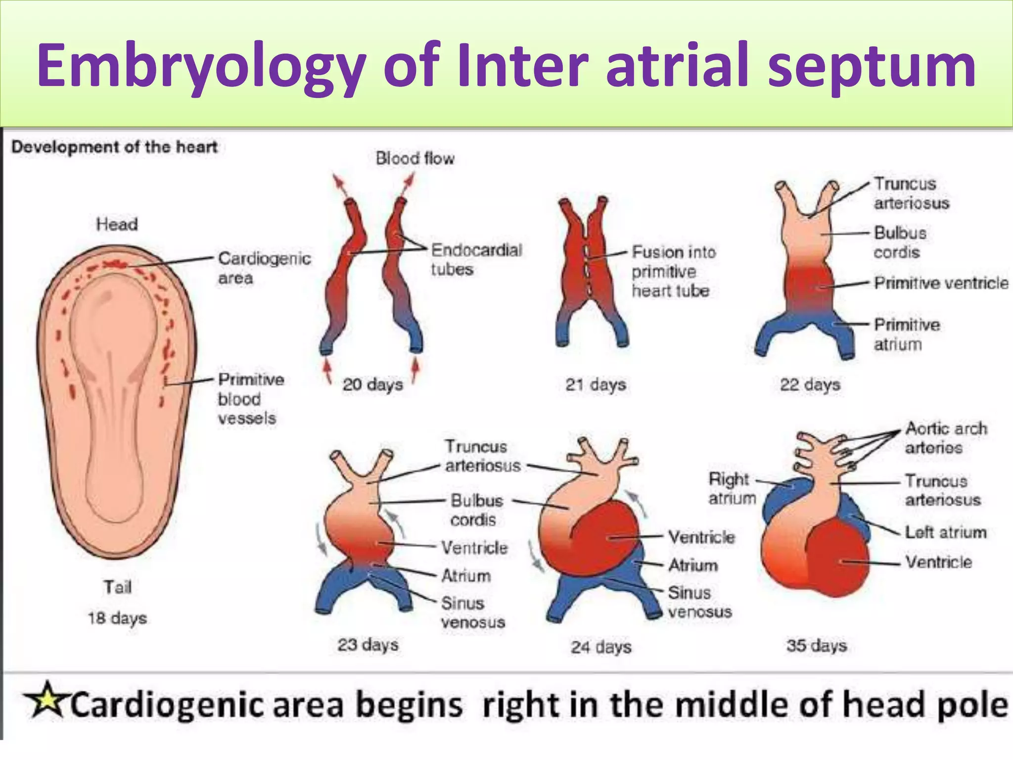 An approach to a patient with Atrial septal defect (ASD) | PPSX