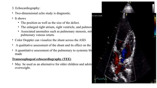 Congenital heart disease - ASD and VSD . | PPTX | Heart and ...