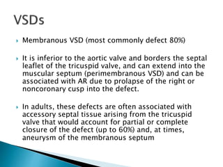ASD ,VSD elkhatib | PPT