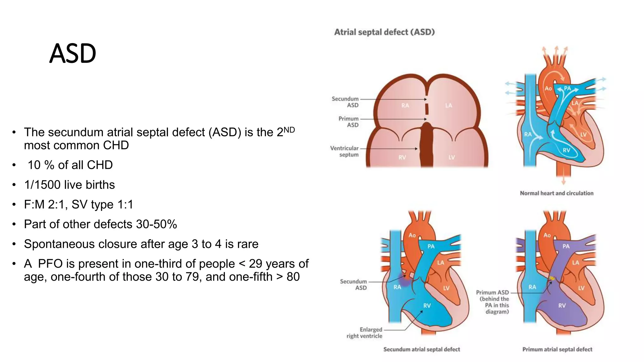 Atrial Septal Defects, Ventricular septal defects Assessment,Investigations and managemnet ASD ...