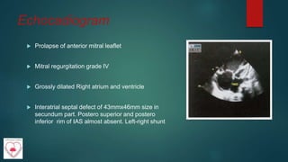 Asd with mitral regurgitation | PPT