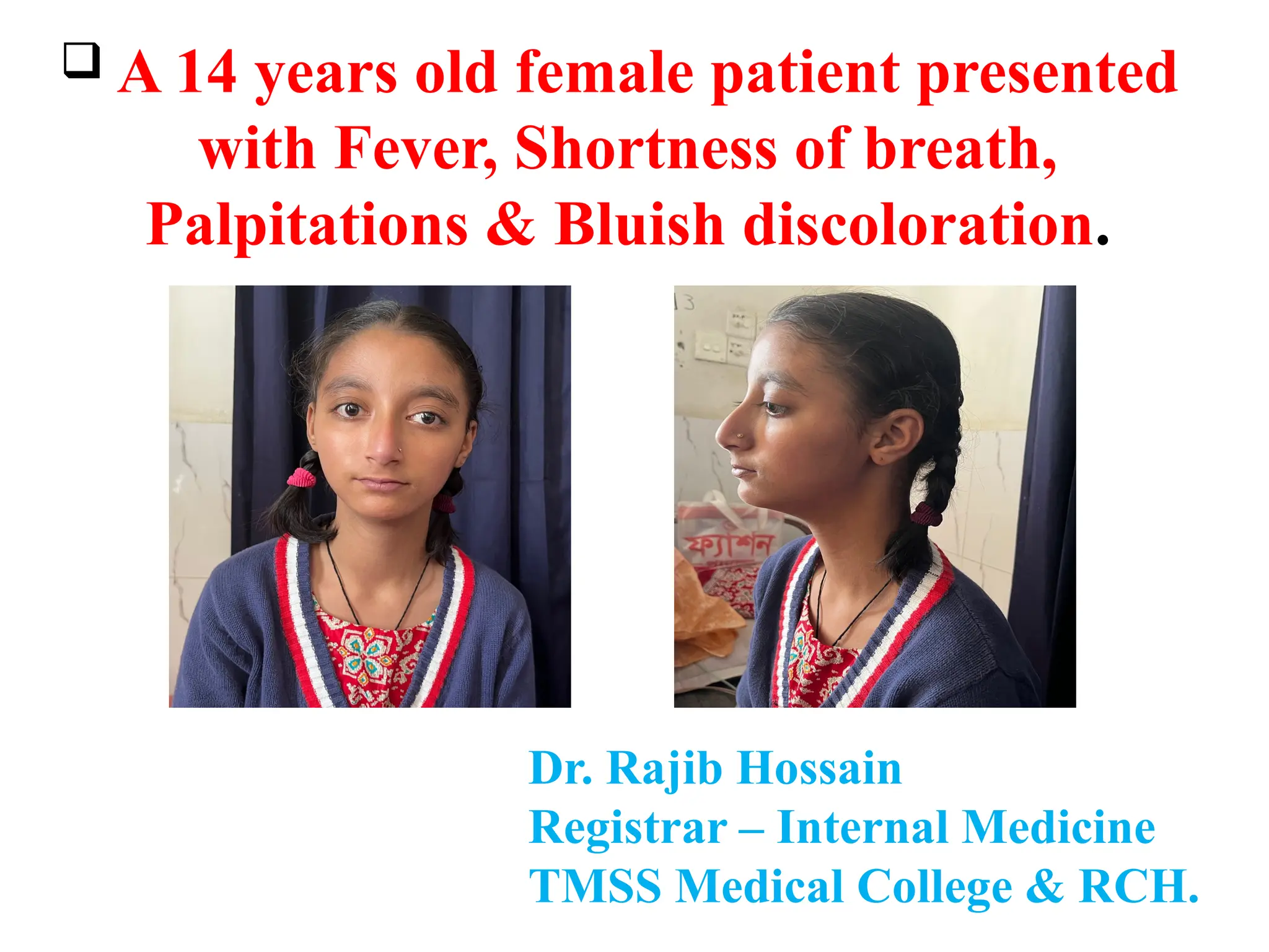 Case Presentation: A 14 years female patient presented with Fever ...