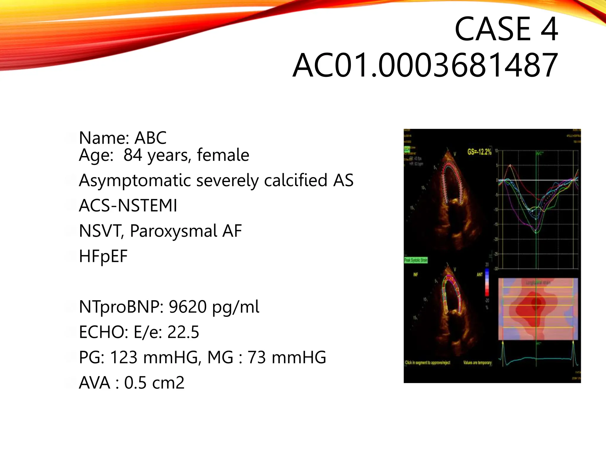 AORTIC STENOSIS ECHO CARDIOLOGY/MEDICINE.PPTX