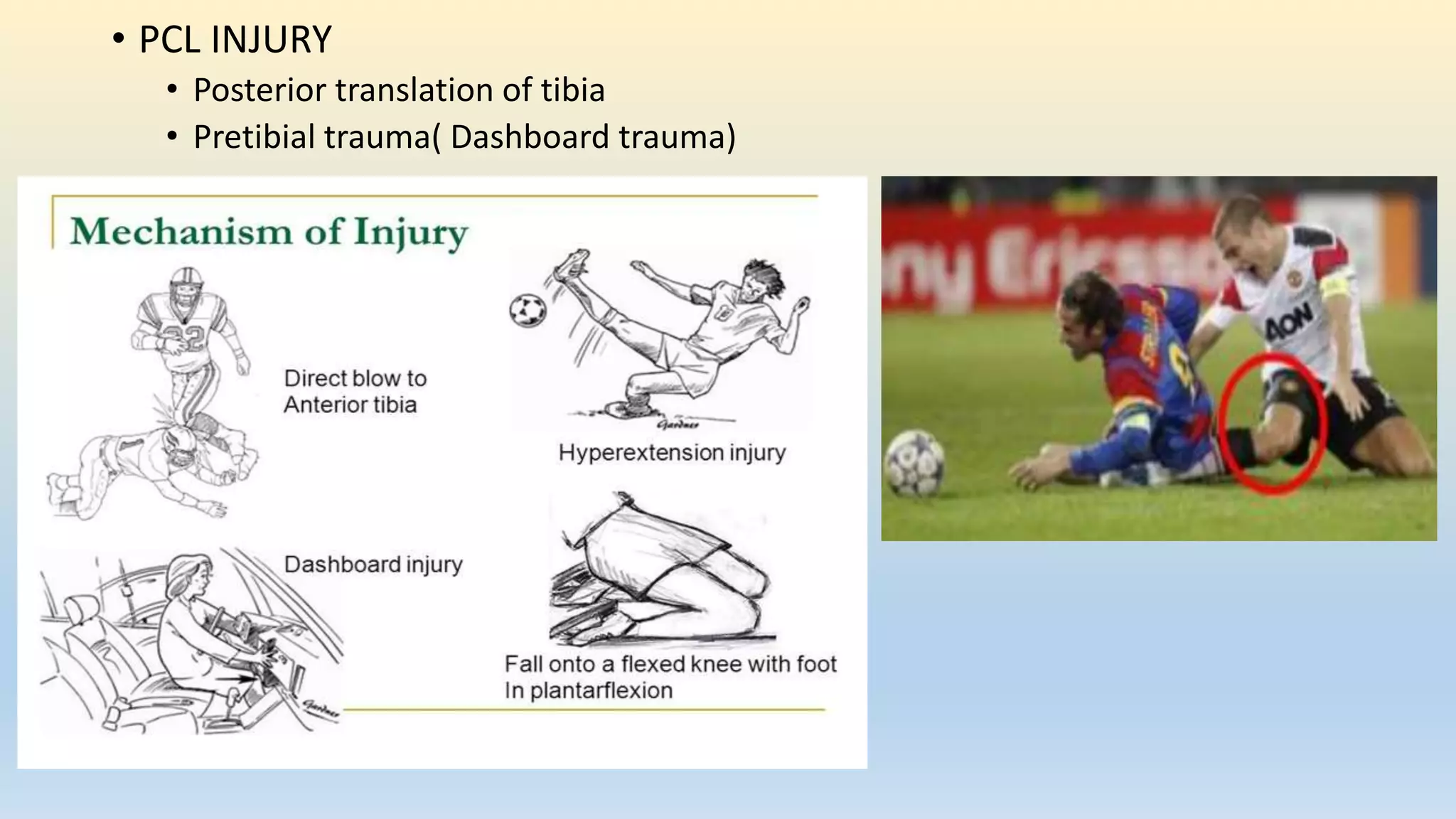 Knee joint assessment | PPTX