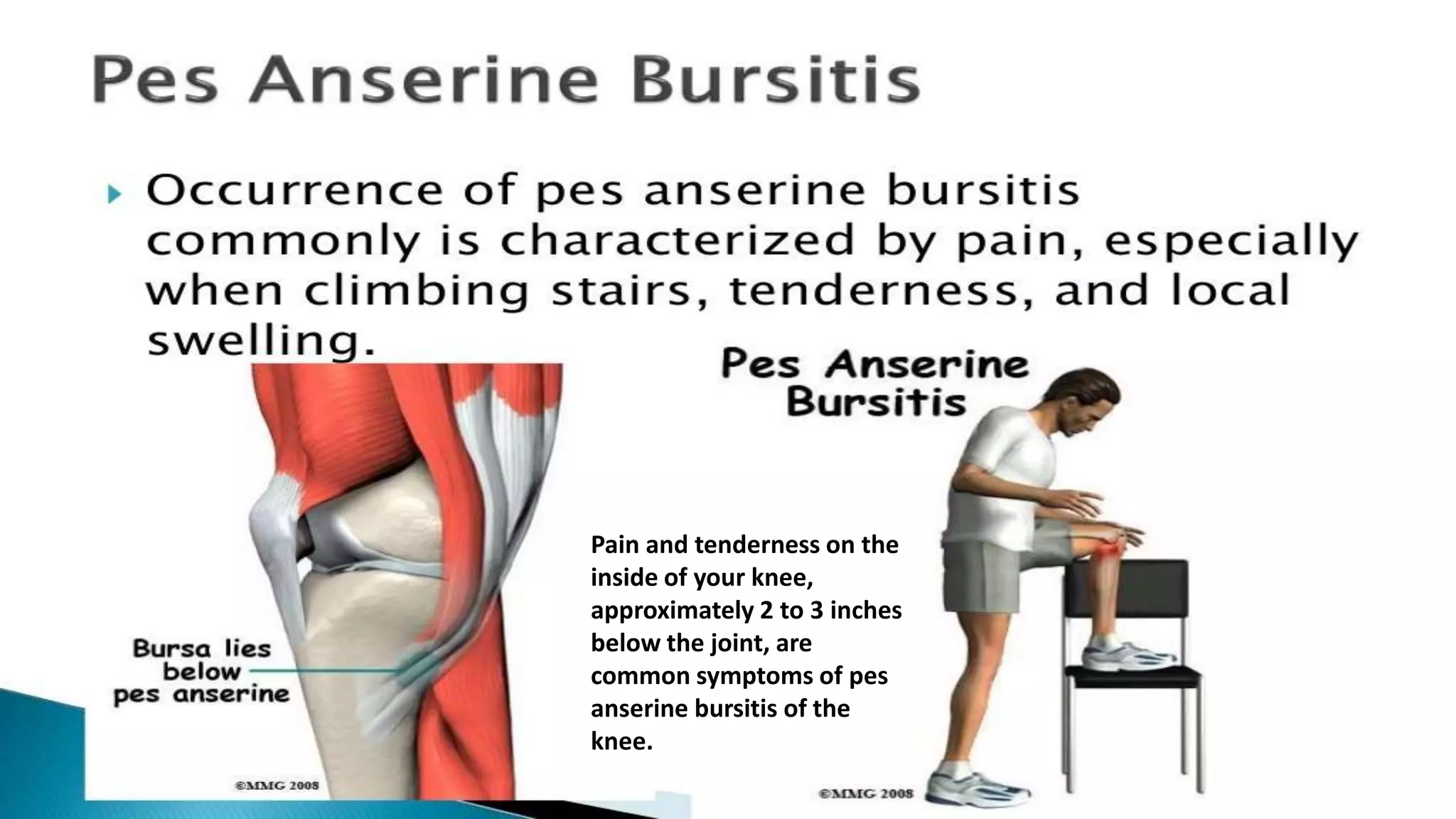 Knee joint assessment | PPTX