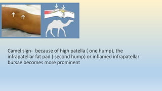 Knee joint assessment | PPTX