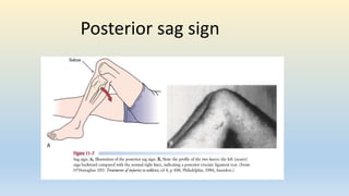Knee joint assessment | PPTX