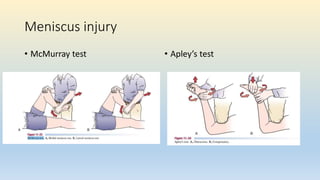 Knee joint assessment | PPTX