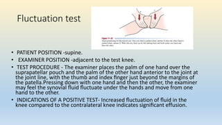 Knee joint assessment | PPTX