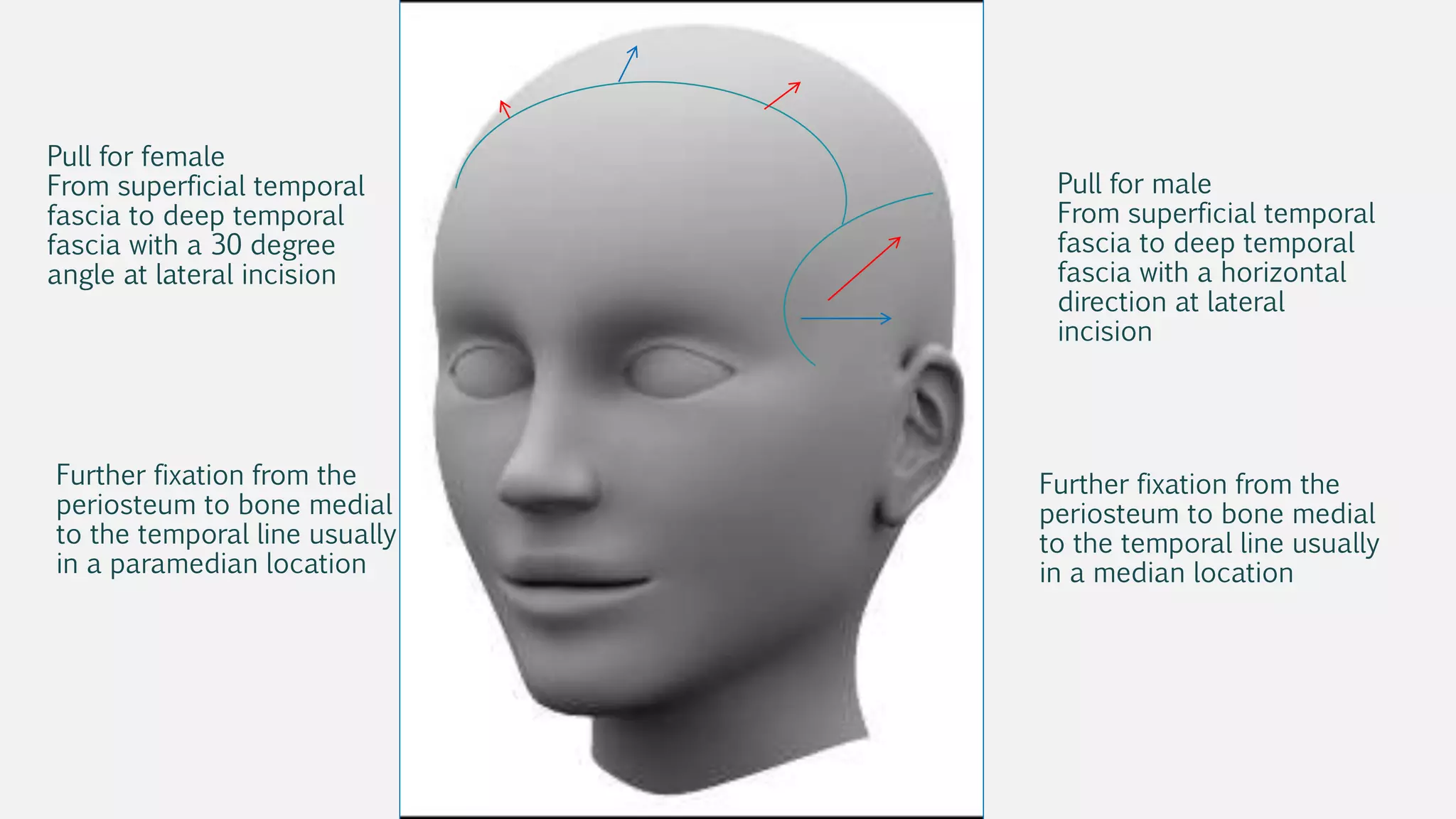 A segmental approach to browlift | PPT