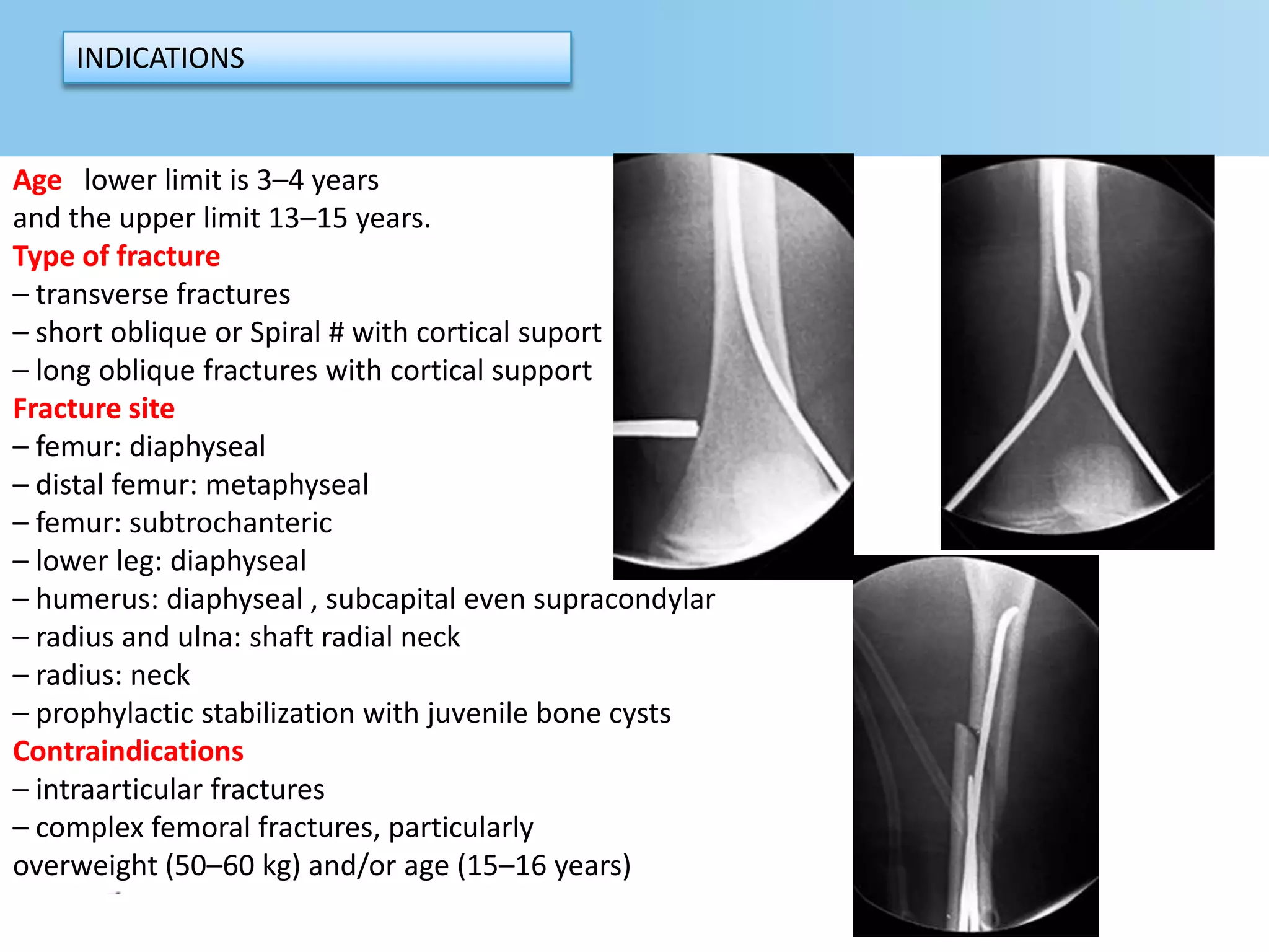 orthopaedic fractures in children | PPTX