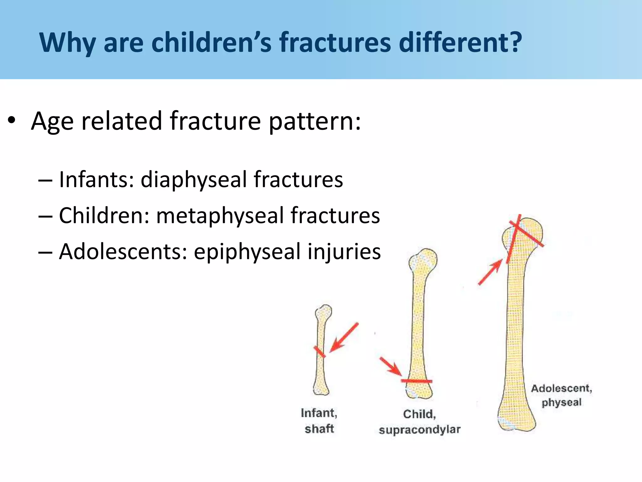 orthopaedic fractures in children | PPTX