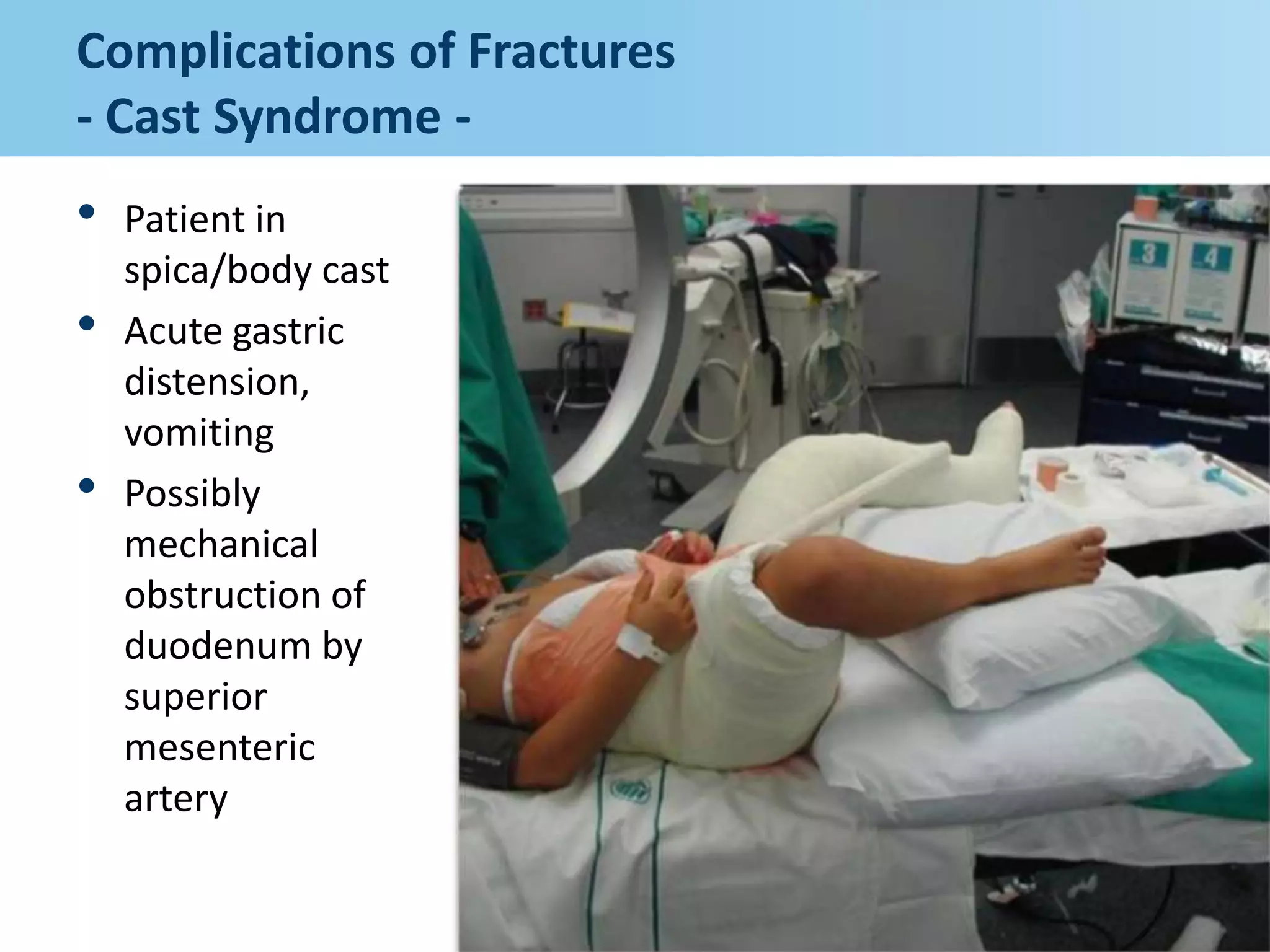 orthopaedic fractures in children | PPTX