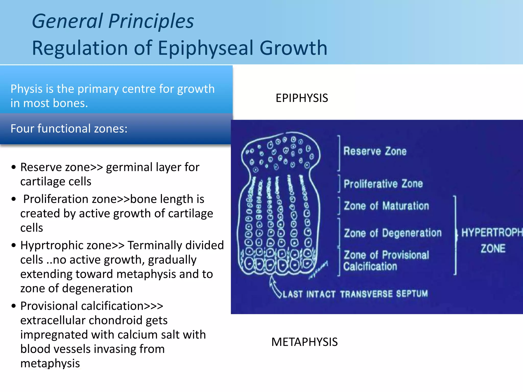 orthopaedic fractures in children | PPTX