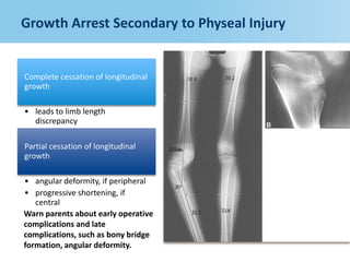 orthopaedic fractures in children | PPTX