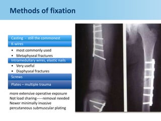orthopaedic fractures in children | PPTX