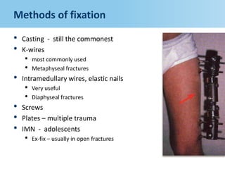orthopaedic fractures in children | PPTX