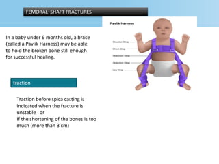orthopaedic fractures in children | PPTX