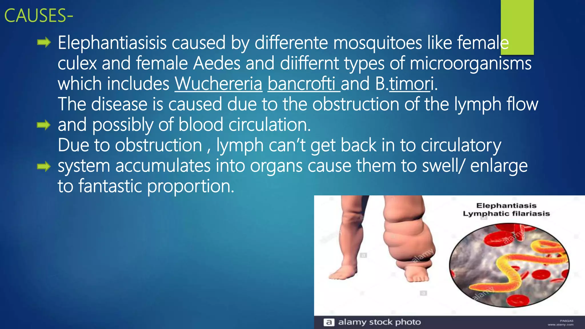 A seminar on Elephantiasis.pptx