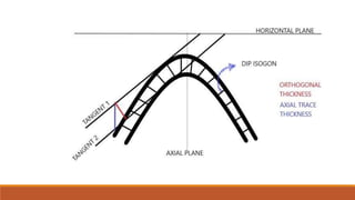 A seminar on ramsay classification of fold | PPTX