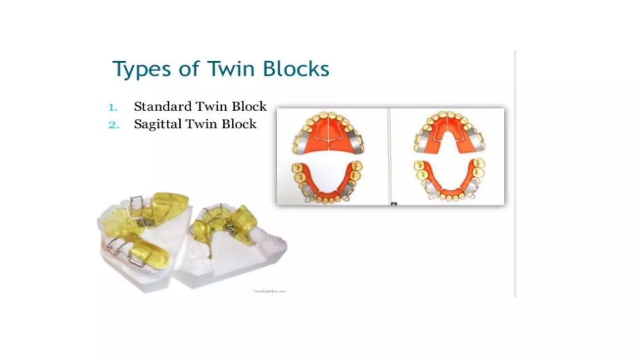 twin block appliance | PPTX