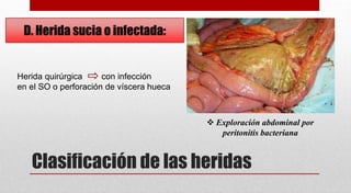 Asepsia, antisepsia, clasificación de las heridas | PPT