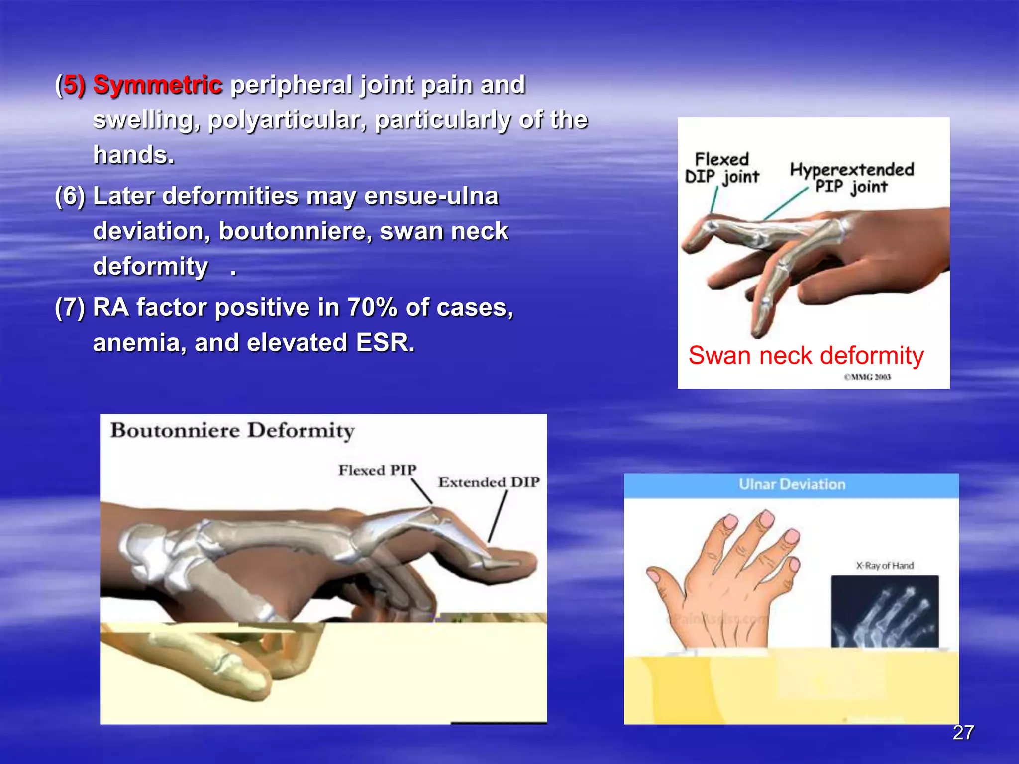 Aseptic arthritis | PPTX