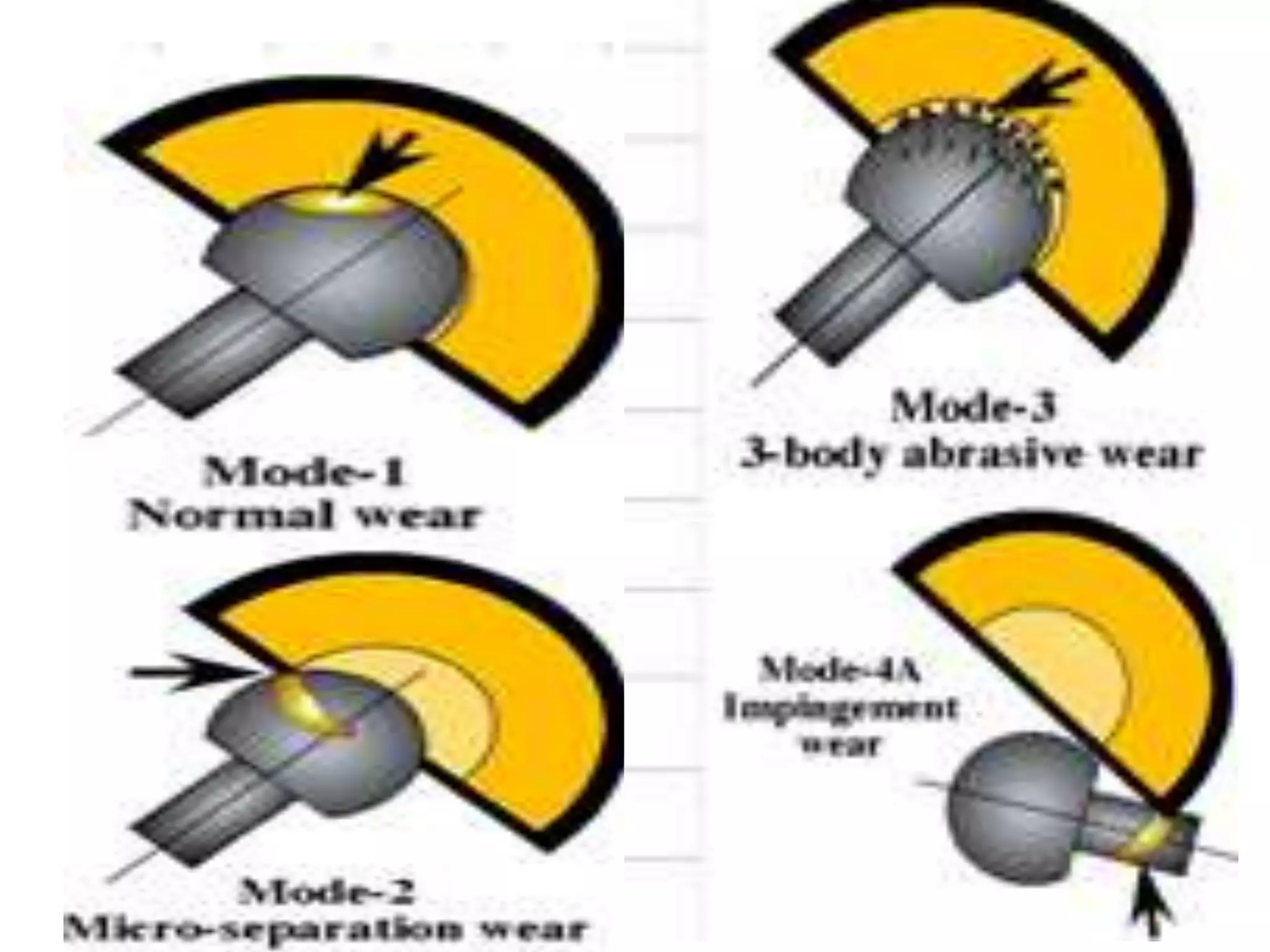 Aseptic loosening total hip arthroplasty | PPTX