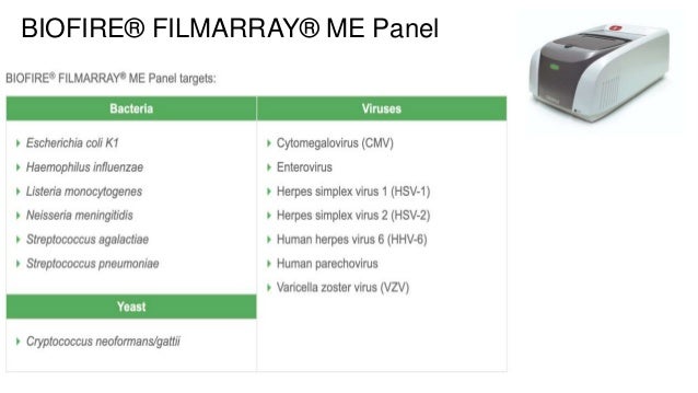 Clinical Approach To Aseptic Meningitis and Encephalitis