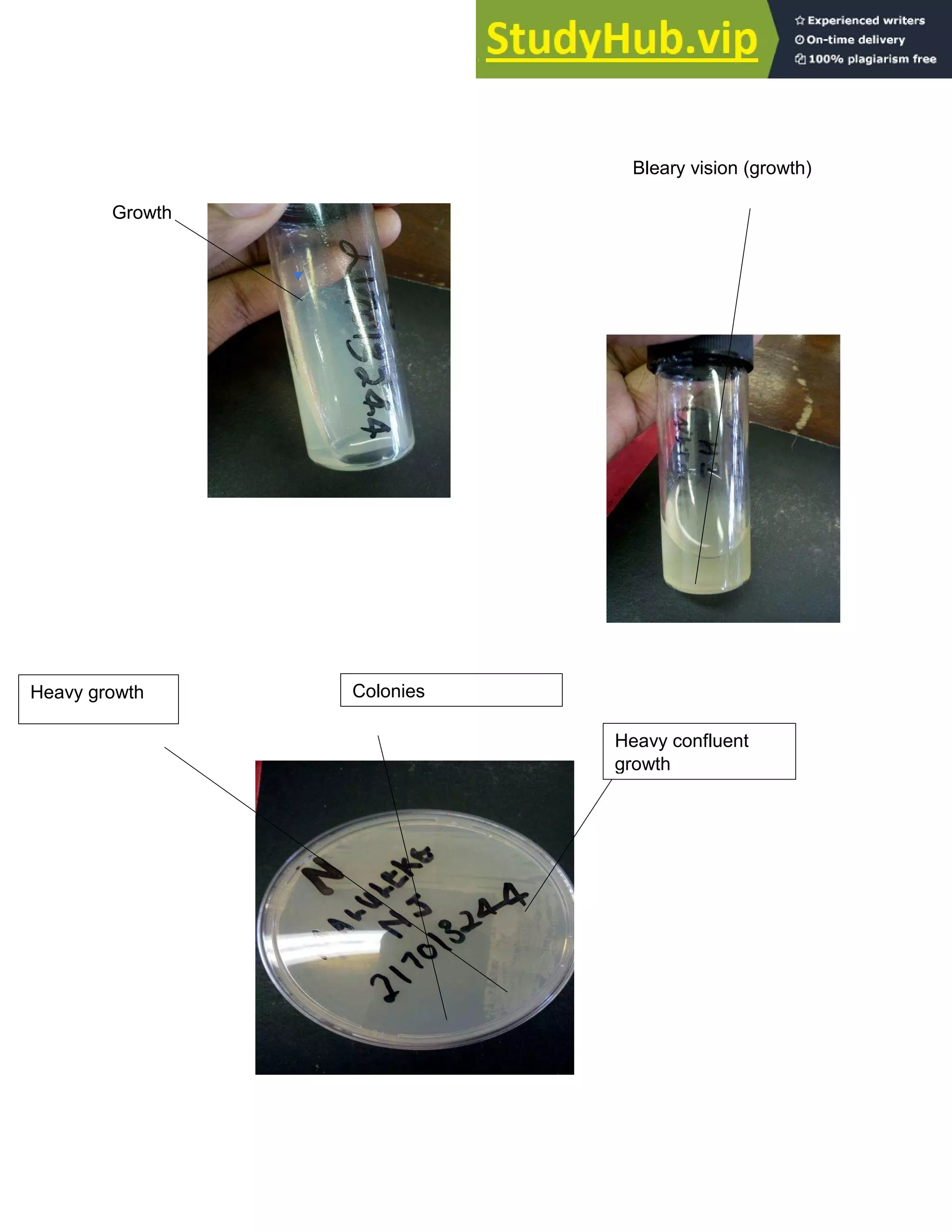 ASEPTIC TECHNIQUES TRANSFER OF BACTERIA | PDF
