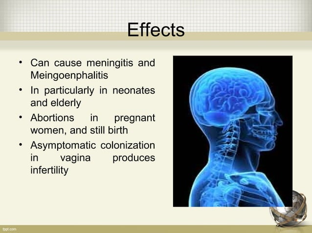 Listeriosis and Colibacillosis | PPT