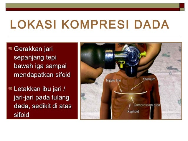 Materi Pelatihan PONED - Asfiksia dan Resusitasi Bayi Baru Lahir